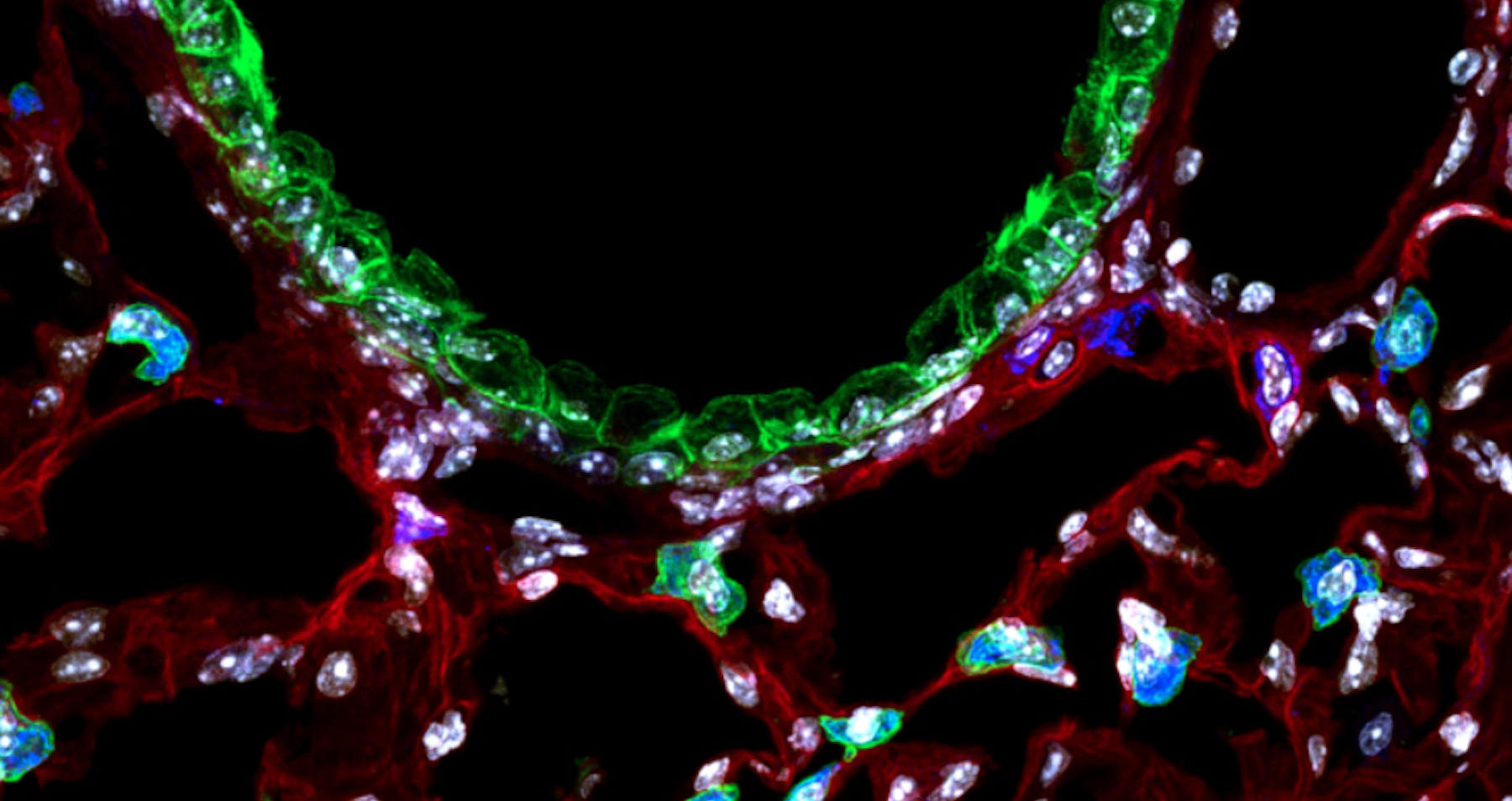 Where Lung Cancer Starts Elife Science Digests Elife