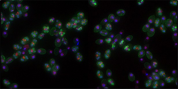 How Sexual Reproduction Rejuvenates Aging Yeast Elife Science Digests Elife