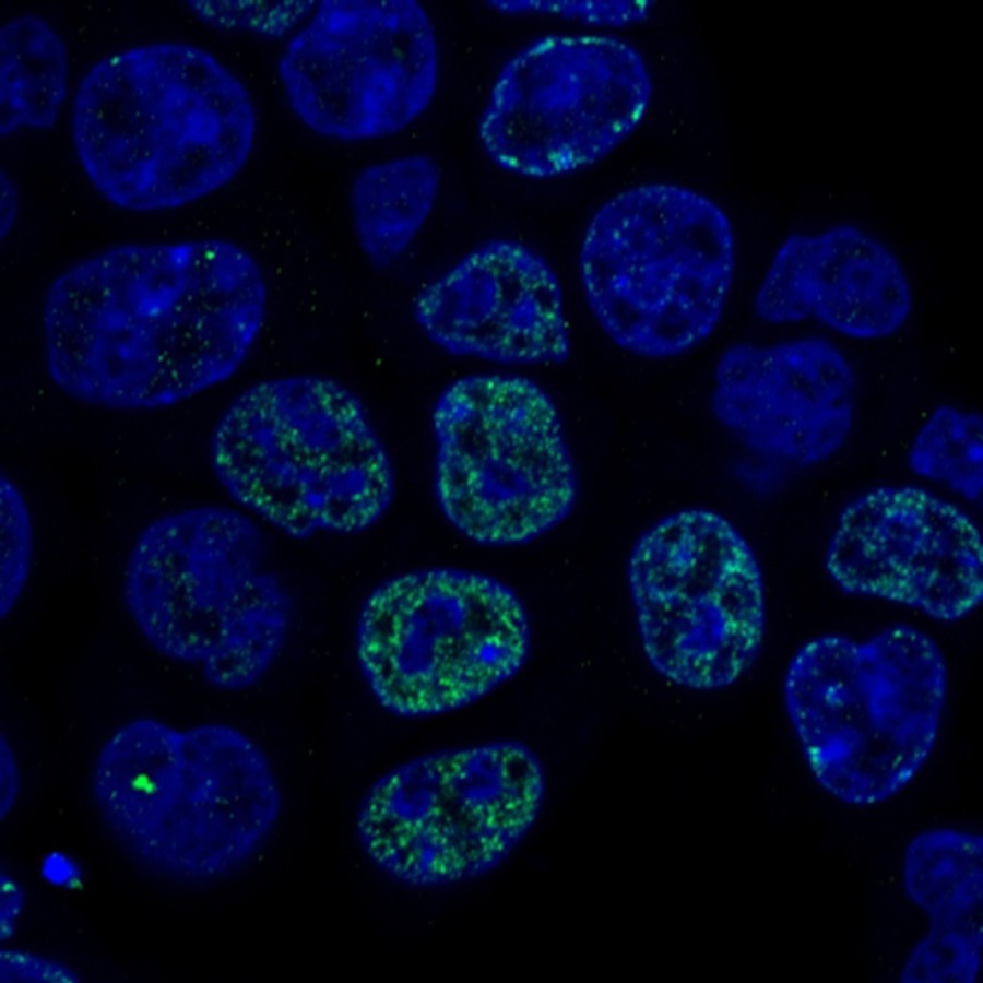 Cracking cancer’s checkpoints | eLife Science Digests | eLife Cracking cancer’s checkpoints | eLife Science Digests | eLife