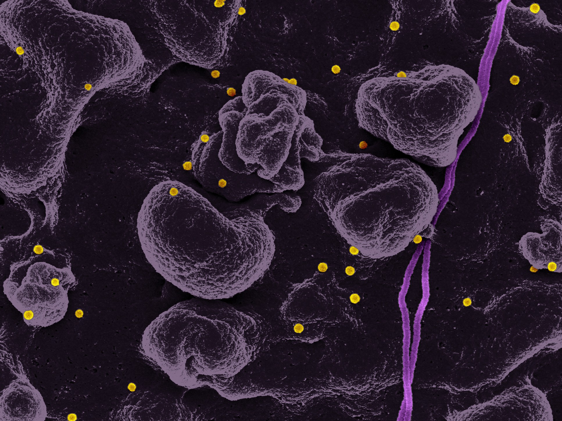 Tracking viral replication | eLife Science Digests | eLife Tracking viral replication | eLife Science Digests | eLife