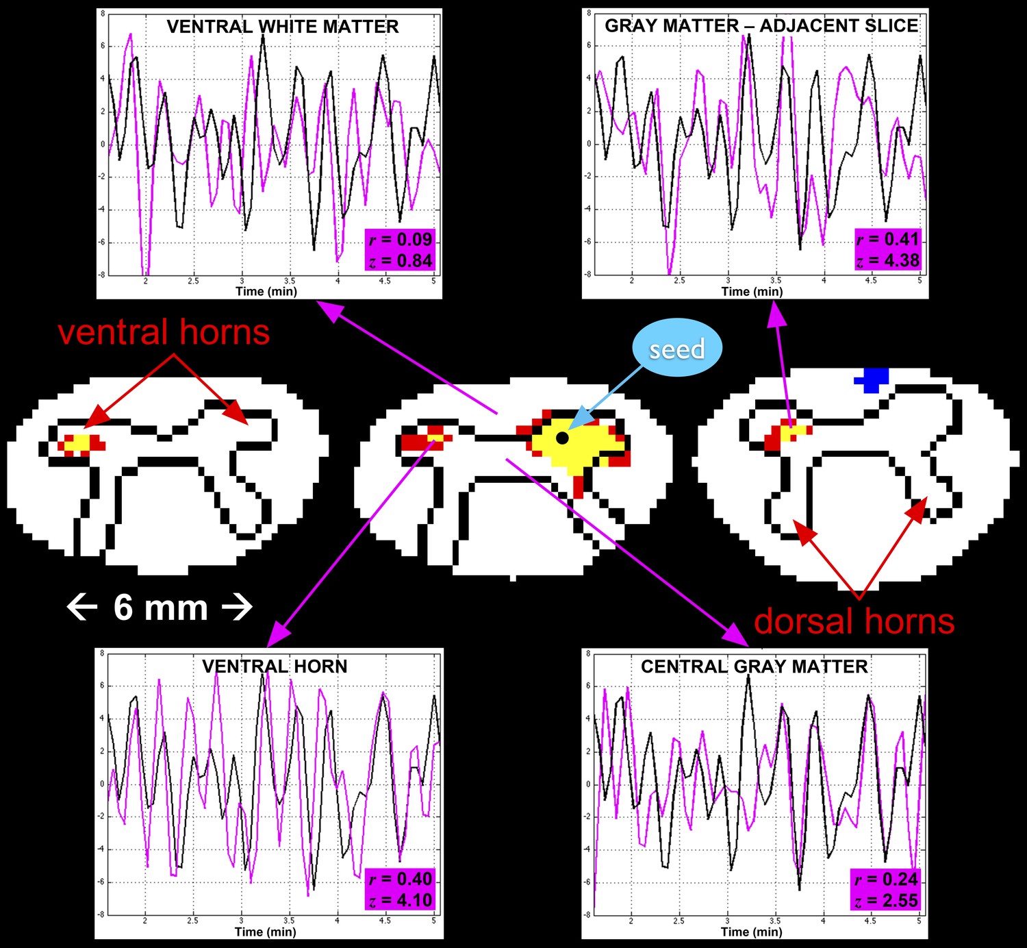 Figures And Data In Resting State Functional Connectivity In The Human