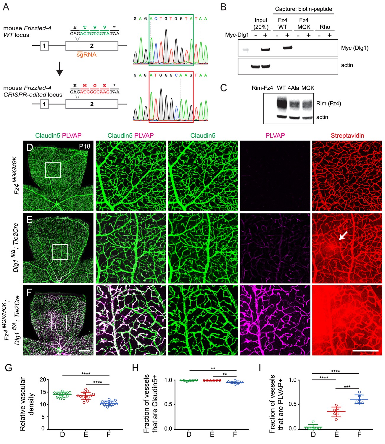 Dlg1 activates beta-catenin signaling to regulate retinal Dlg1 activates beta-catenin signaling to regulate retinal