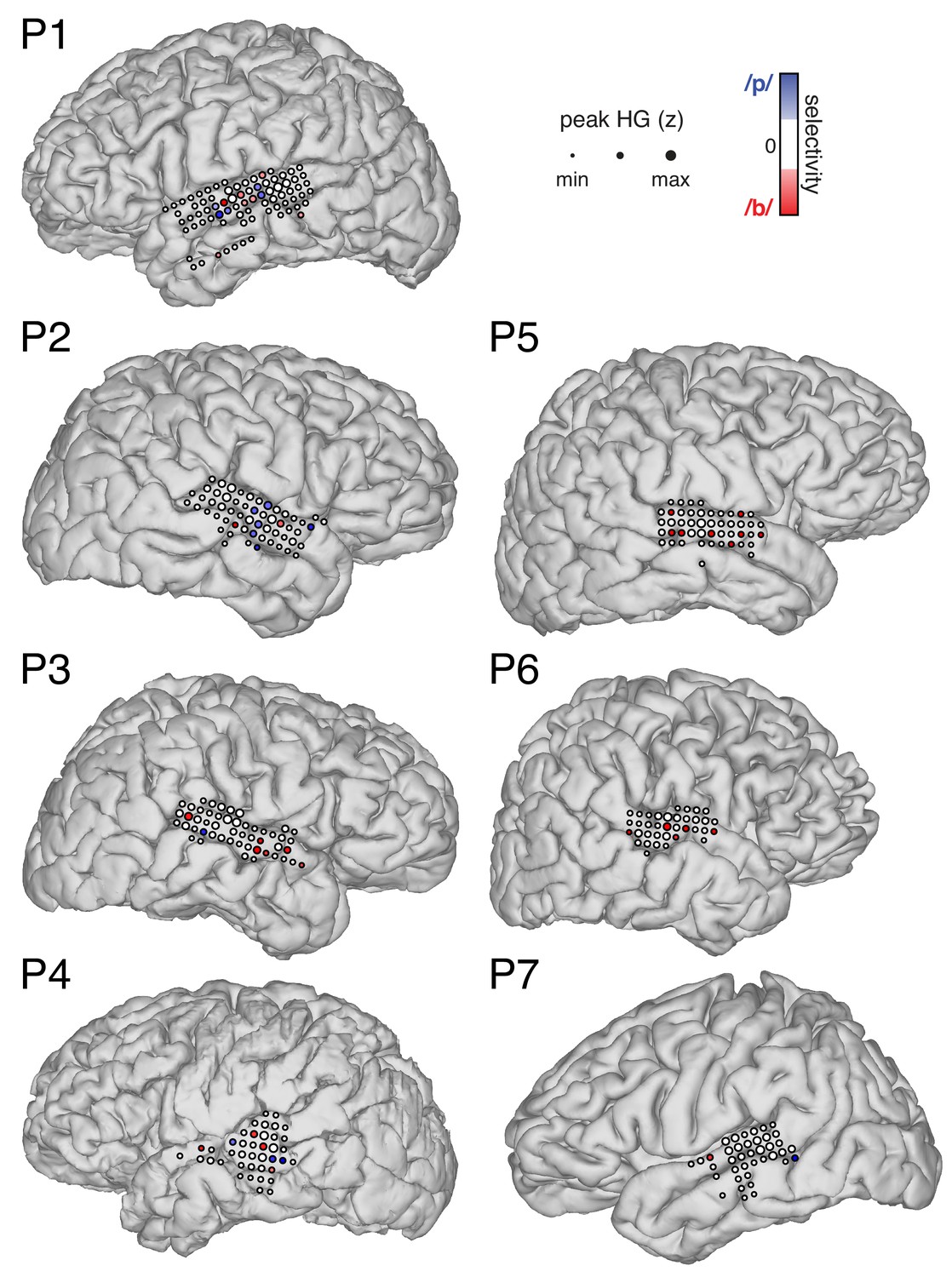 Figures And Data In Transformation Of A Temporal Speech Cue To A Spatial Neural Code In Human