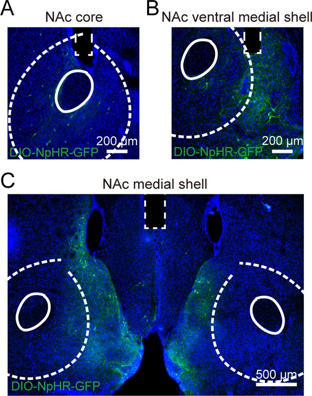 Figures And Data In Mecp2 In Cholinergic Interneurons Of Nucleus