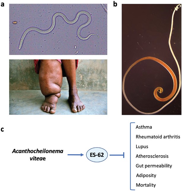Gross Ways To Live Long Parasitic Worms As An Anti Inflammaging