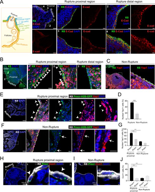Selective YAP activation in Procr cells is essential for ovarian stem ...