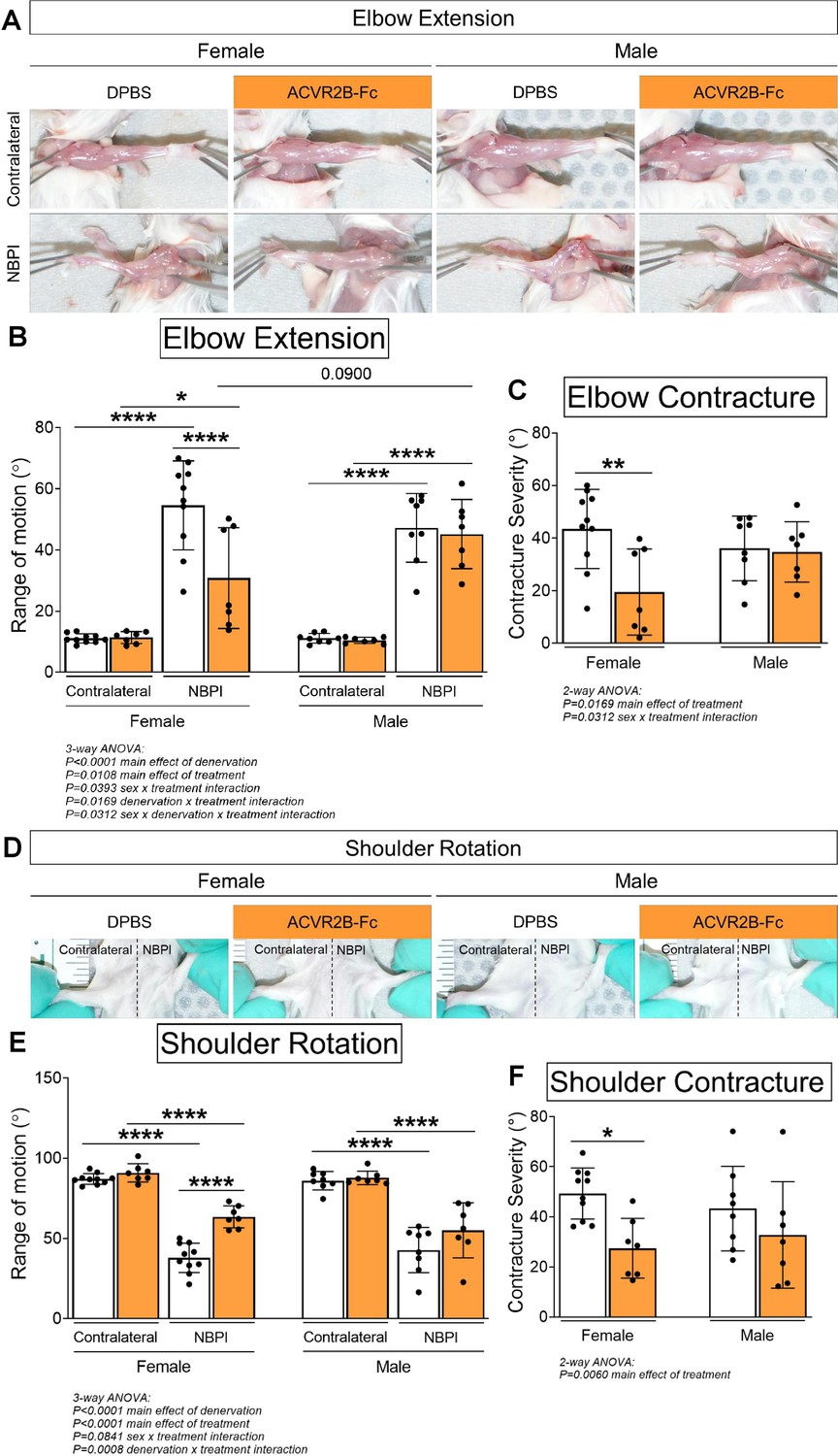 Figures And Data In Sex Specific Role Of Myostatin Signaling In