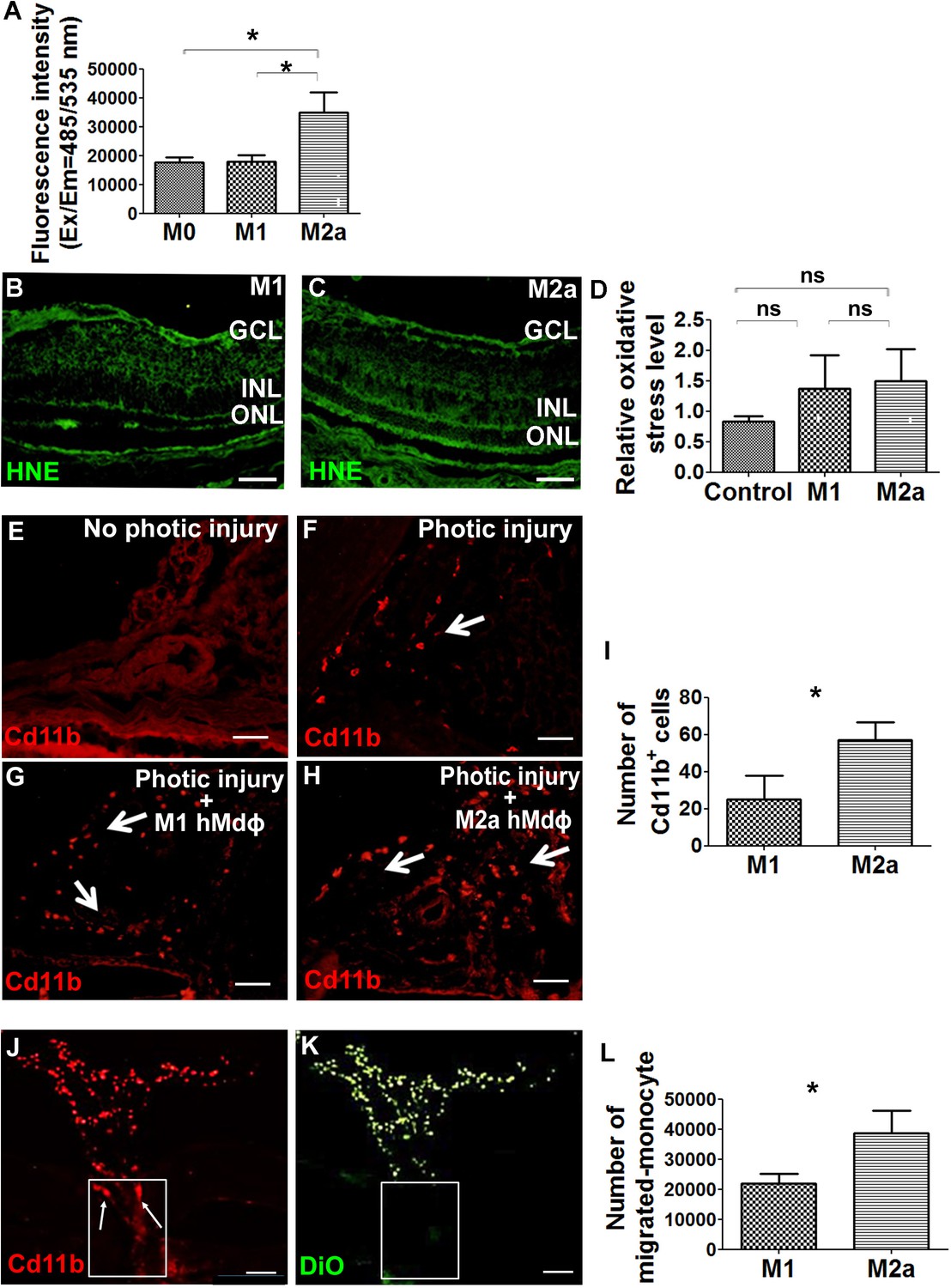 Figures And Data In Ccr1 Mediates Müller Cell Activation And