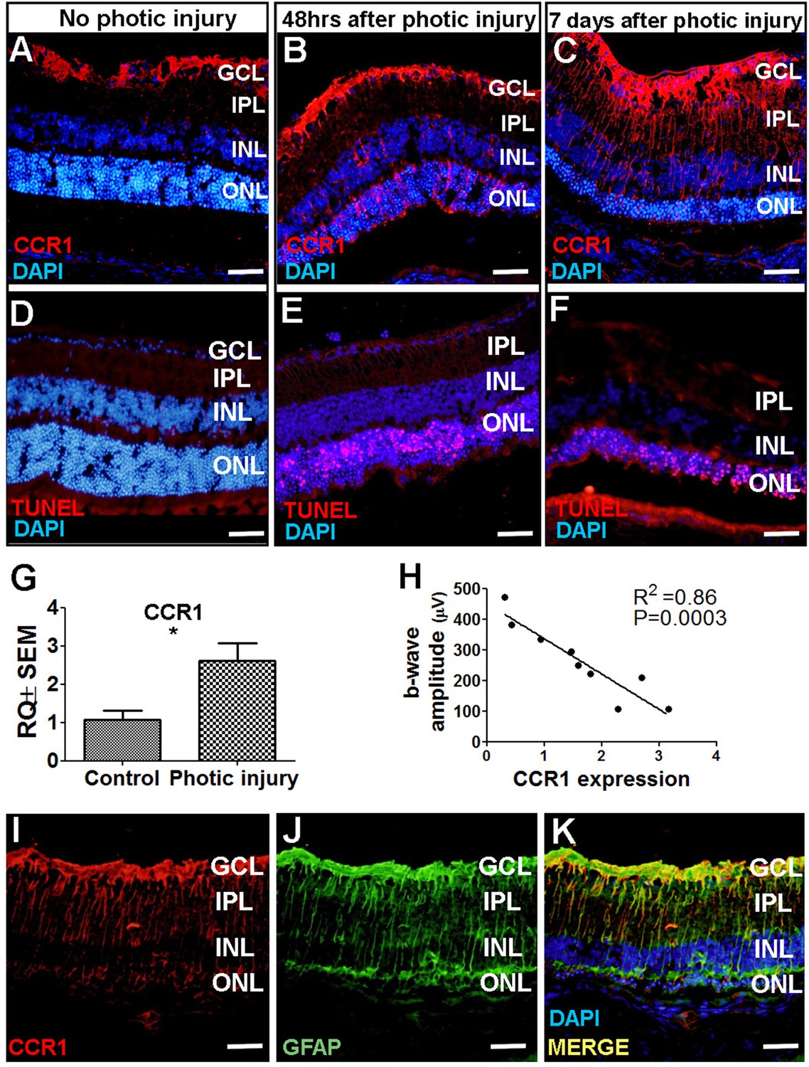Figures And Data In Ccr1 Mediates Müller Cell Activation And