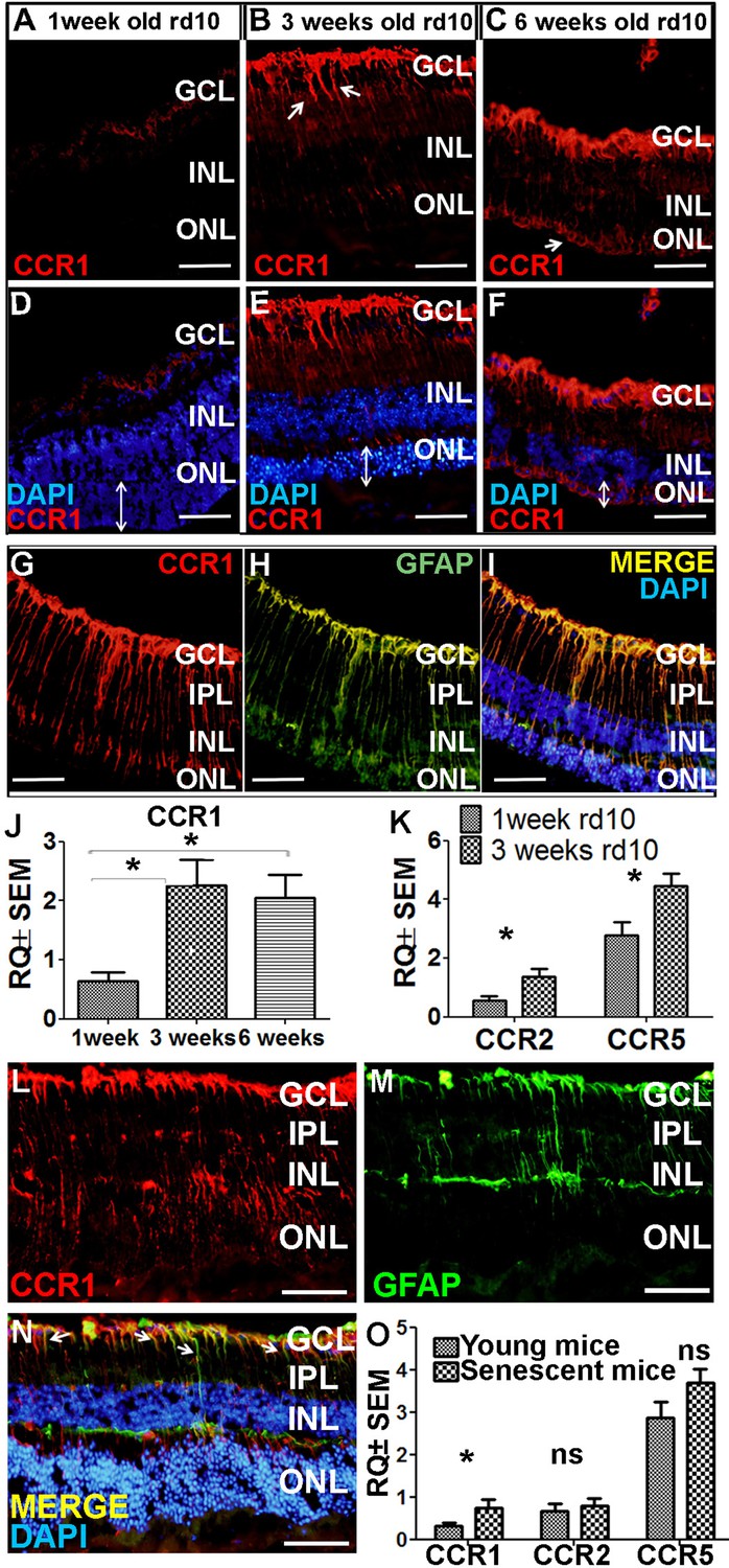 Figures And Data In Ccr1 Mediates Müller Cell Activation And